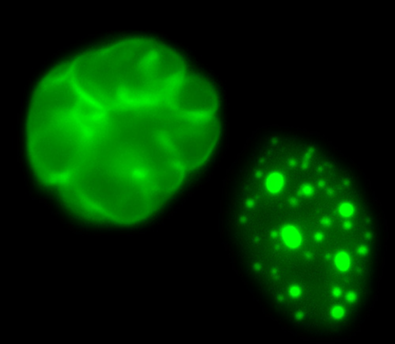A Case of Benjamin Button: The role of p53 in Hutchinson-Gilford ...