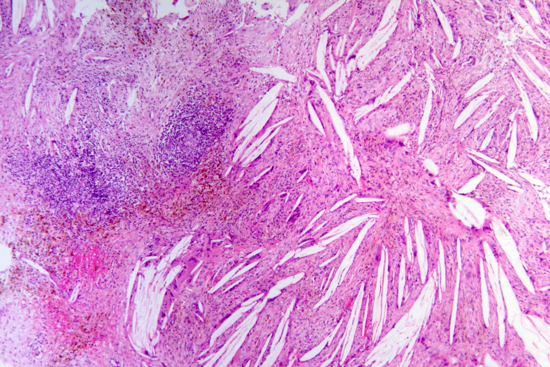 Underlying Factors of the Hallmarks of Cancer – BIOL312 @UNBC ...